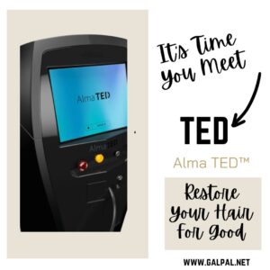 Exciting new Alma TED hair restoration treatment -benefits-proven results
