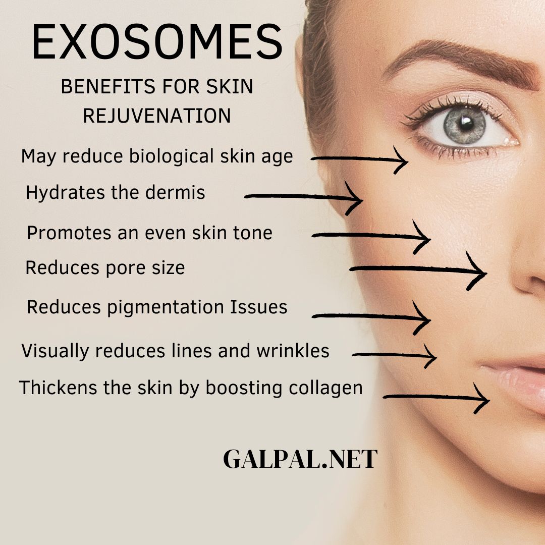My microneedling with exosomes therapy review with photos